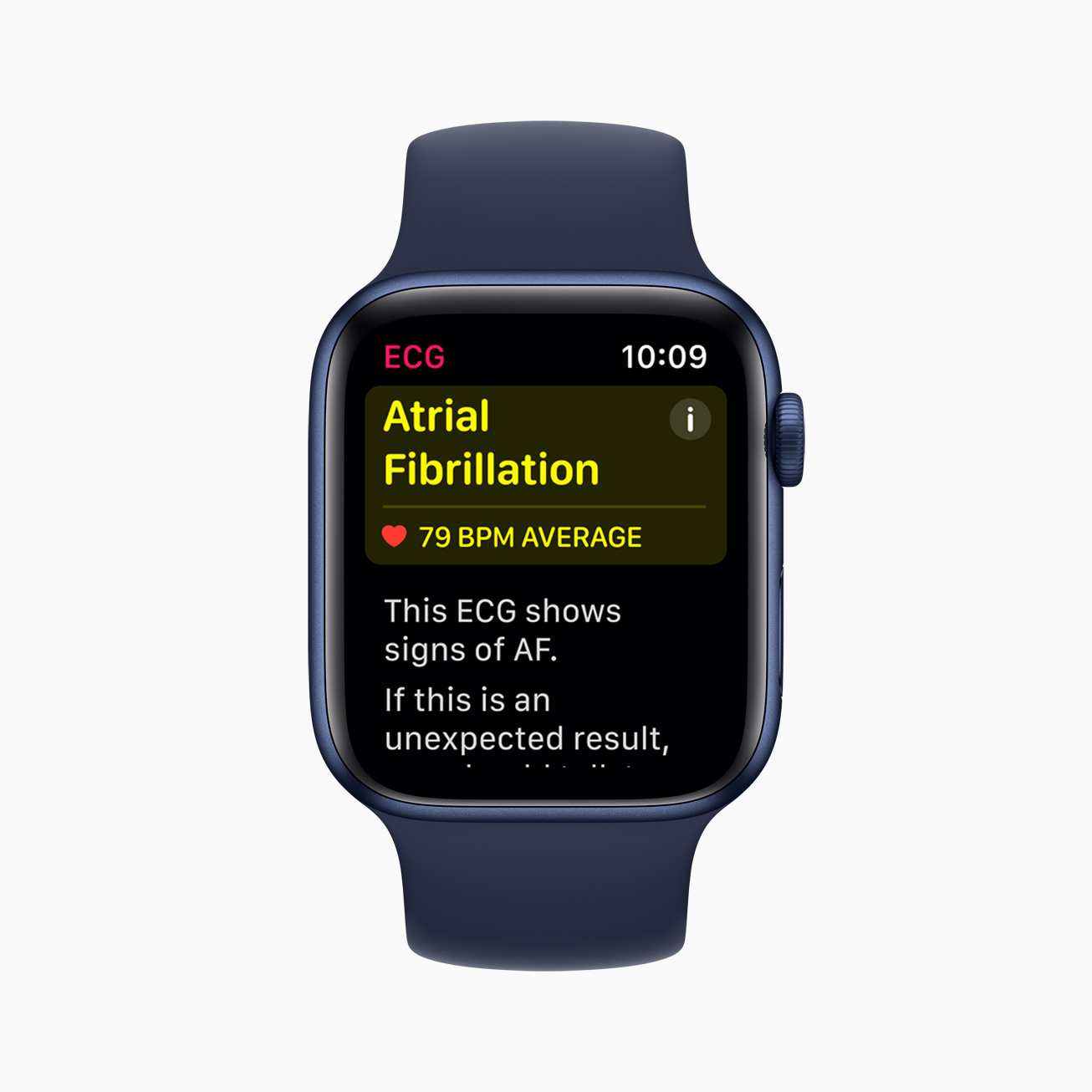 ECG app and irregular rhythm notification now available on Apple Watch ...